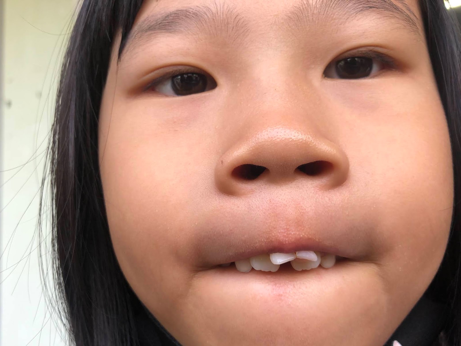 Journal for Jo Ern: SE's front teeth