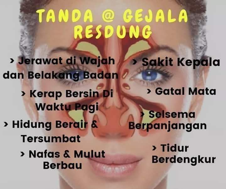 Laresdkan ada.
