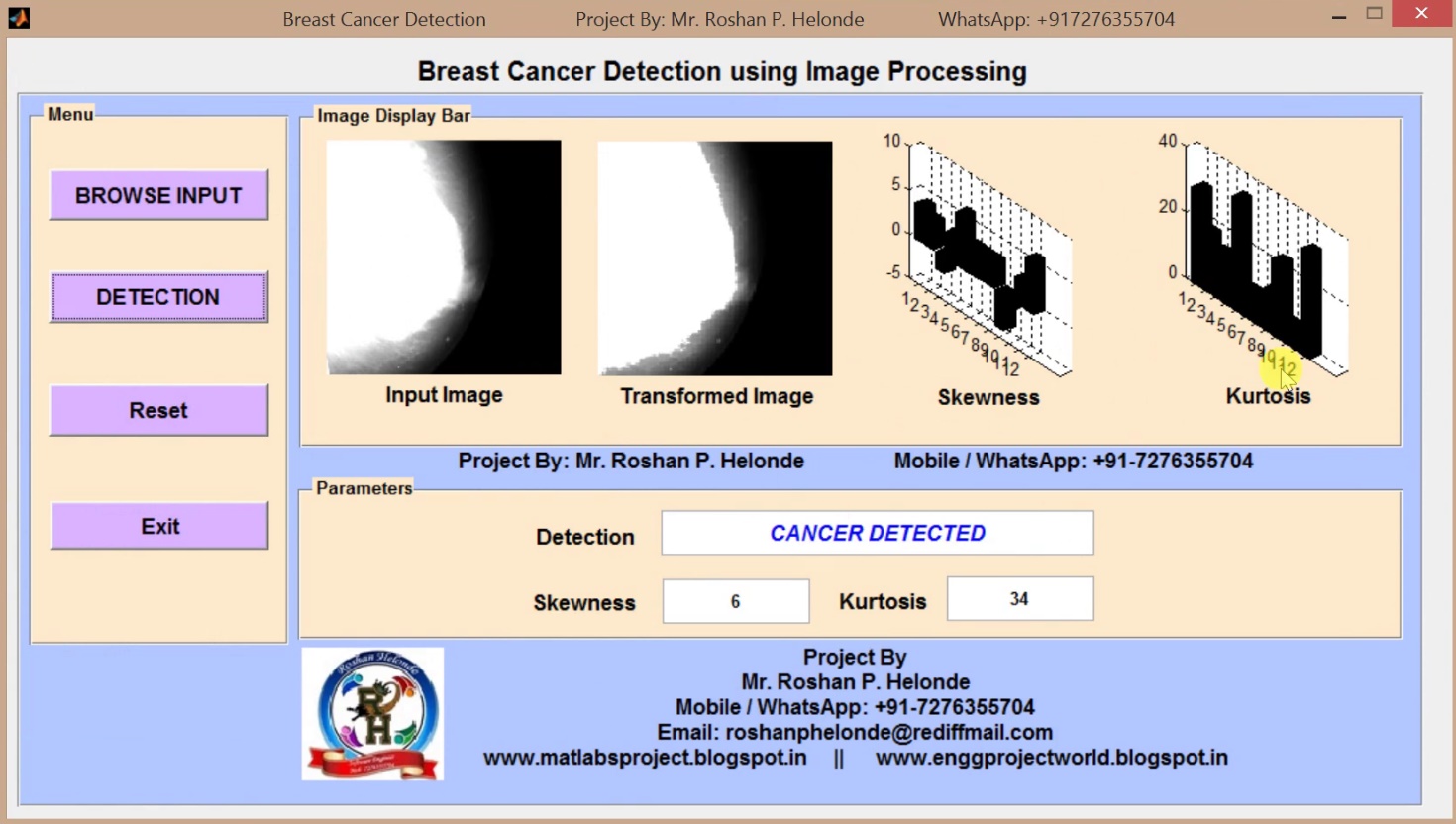 Breast Cancer Detection Using Image Processing Matlab Project Source Code ~ Matlab Projects