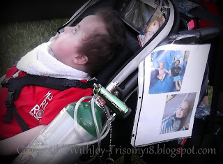 Compatible With Joy-Trisomy18: 06/01/2015 - 07/01/2015