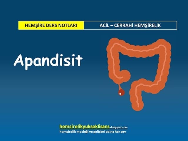 APANDİSİT