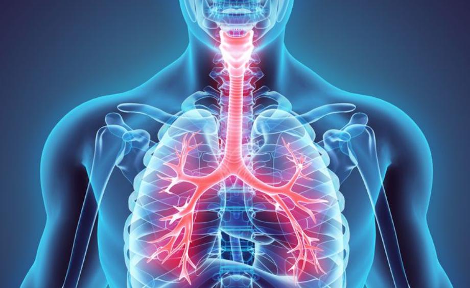 Tracheal Cancer Life Expectancy - CancerOz