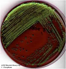 Mikrobiologi air: Analisis kualitatif standar menggunakan metode MPN ...