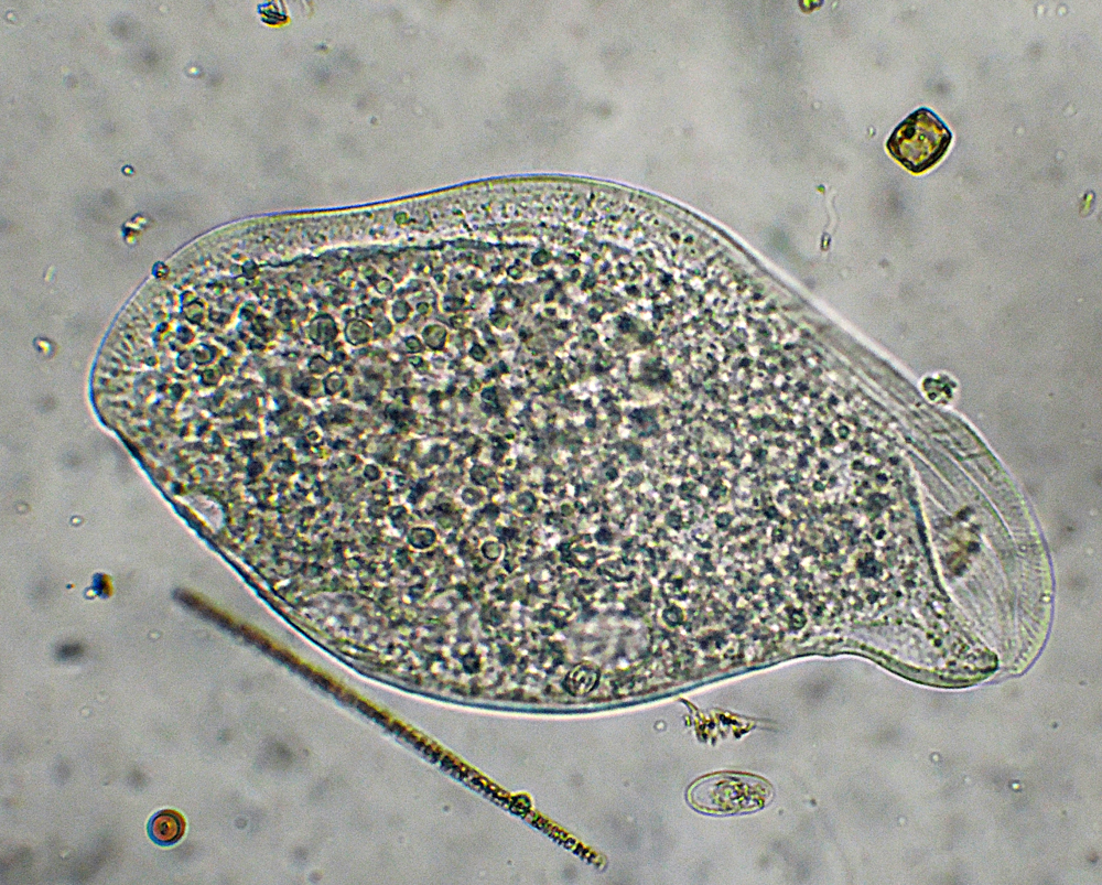 Il Microscopio: VARI CILIATI
