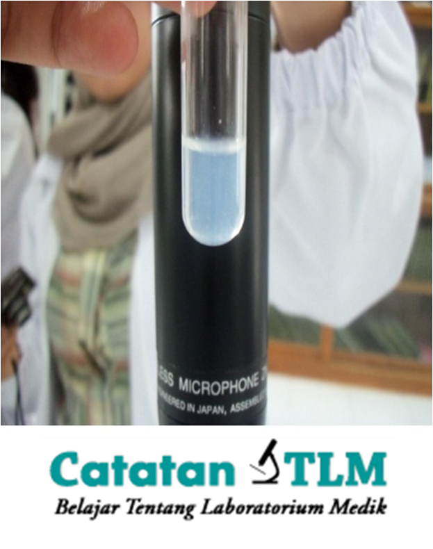 Pemeriksaan Laboratorium Nonne Dan Pandy /Artikel-Dokter-Anda/ Periksa ...