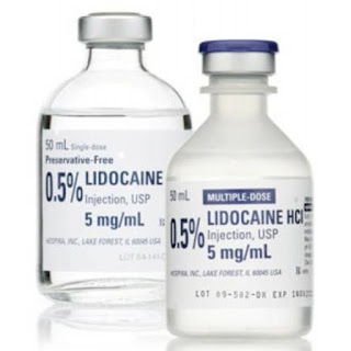 Lidocaine injection