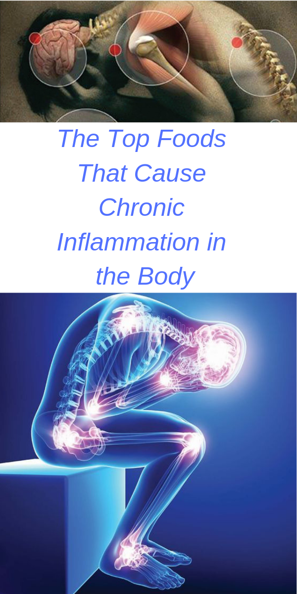 The Top Foods That Cause Chronic Inflammation in the Body - Health care