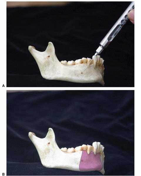 Dentistry lectures for MFDS/MJDF/NBDE/ORE: Anatomical Considerations in ...