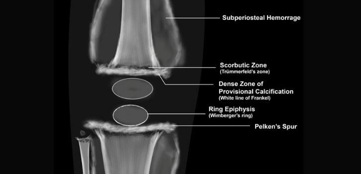 Pediatric Musculoskeletal (MSK) X-ray OSCE • DNB Pediatrics