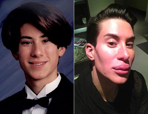 Chatter Busy: Real Life Ken Plastic Surgery