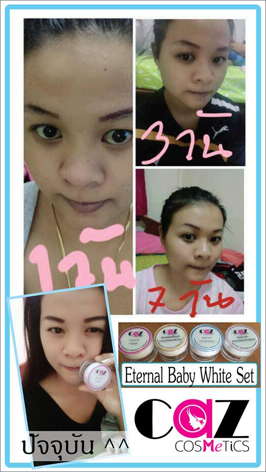 Thailand Beauty Products Supplier: CAZ Eternal Baby White Set
