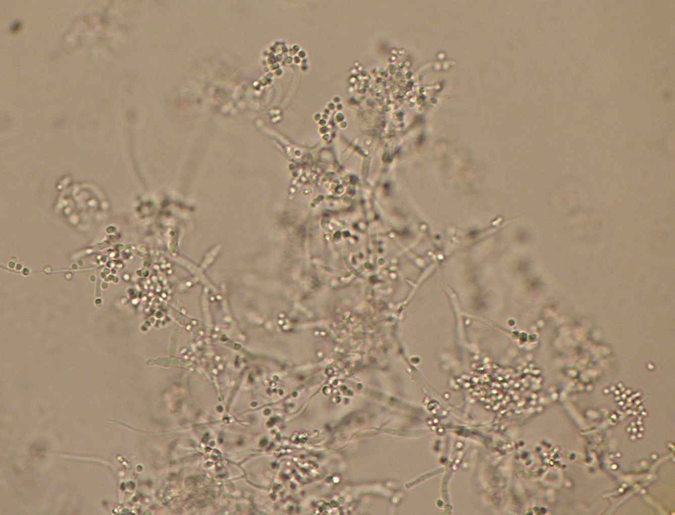 ATLAS MICOLOGIA: TRICHOPHYTON MENTAGROPHYTES