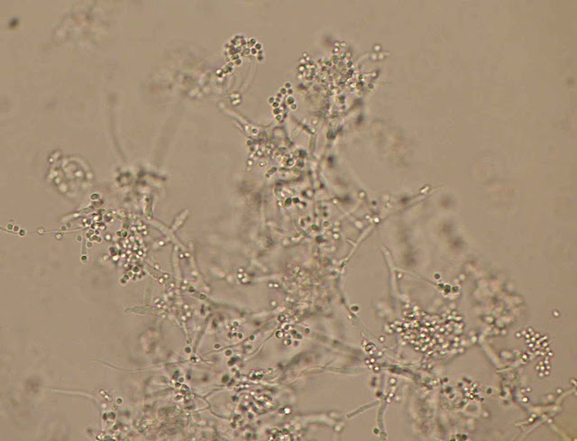 ATLAS MICOLOGIA: TRICHOPHYTON MENTAGROPHYTES