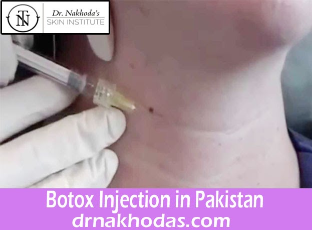 Brief about Botox Injections and the components used in manufacturing it