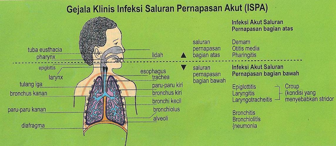 VOKALKUUCAPKANKAWAN: ISPA (Infeksi Saluran Pernafasan Acut)
