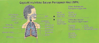 VOKALKUUCAPKANKAWAN: ISPA (Infeksi Saluran Pernafasan Acut)