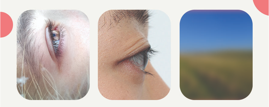 EFIL Bulging Eyes Plastic Surgery JCI: I have bulgy eyes! Why do my ...