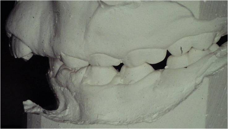 practical orthodontics: Diagnosis and treatment of mesially rotated ...
