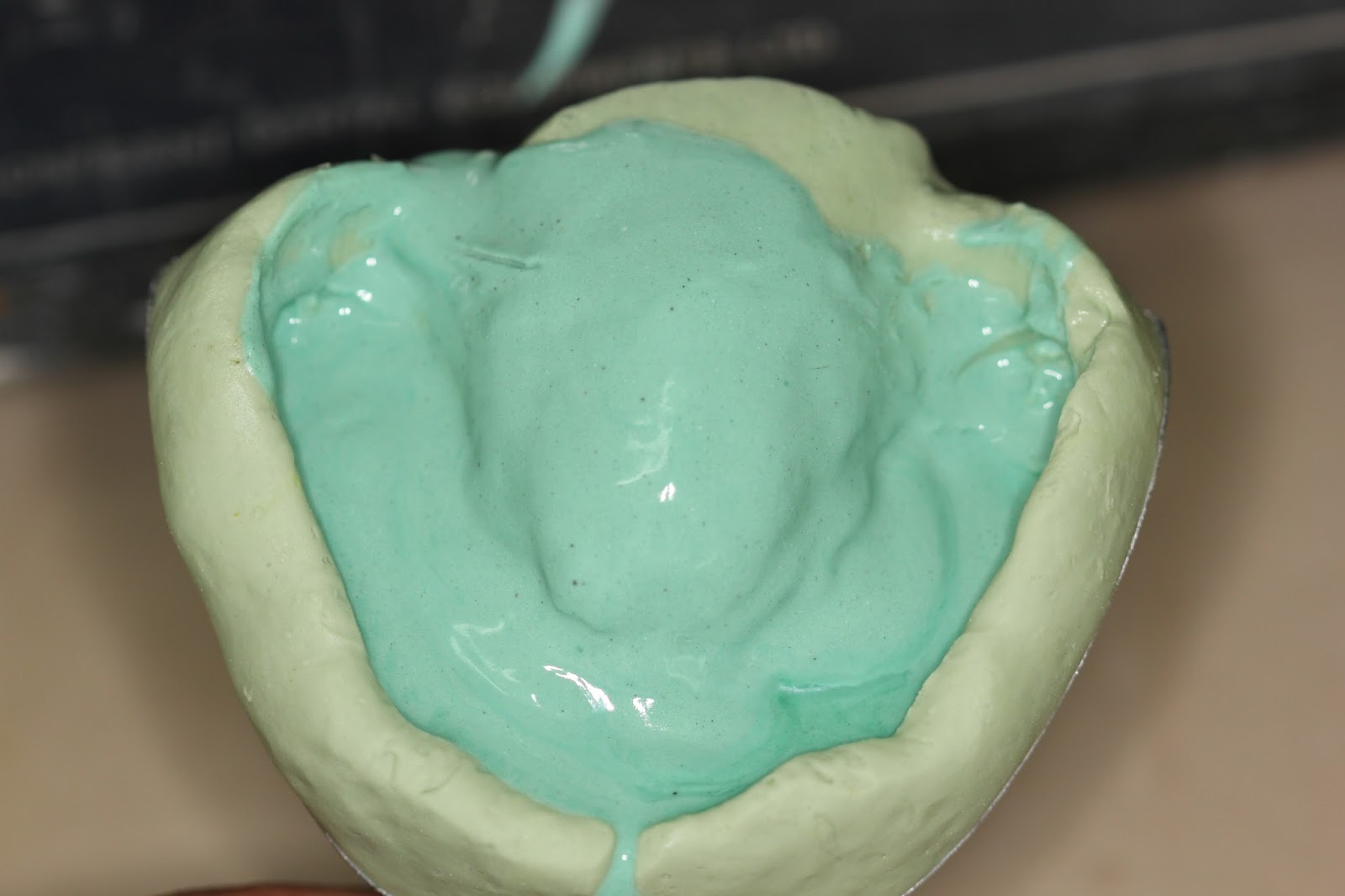 Understanding Prosthodontics - Tagore Dental College & Hospital-By ...