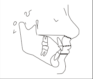 Anatomia dos lábios:sua importância