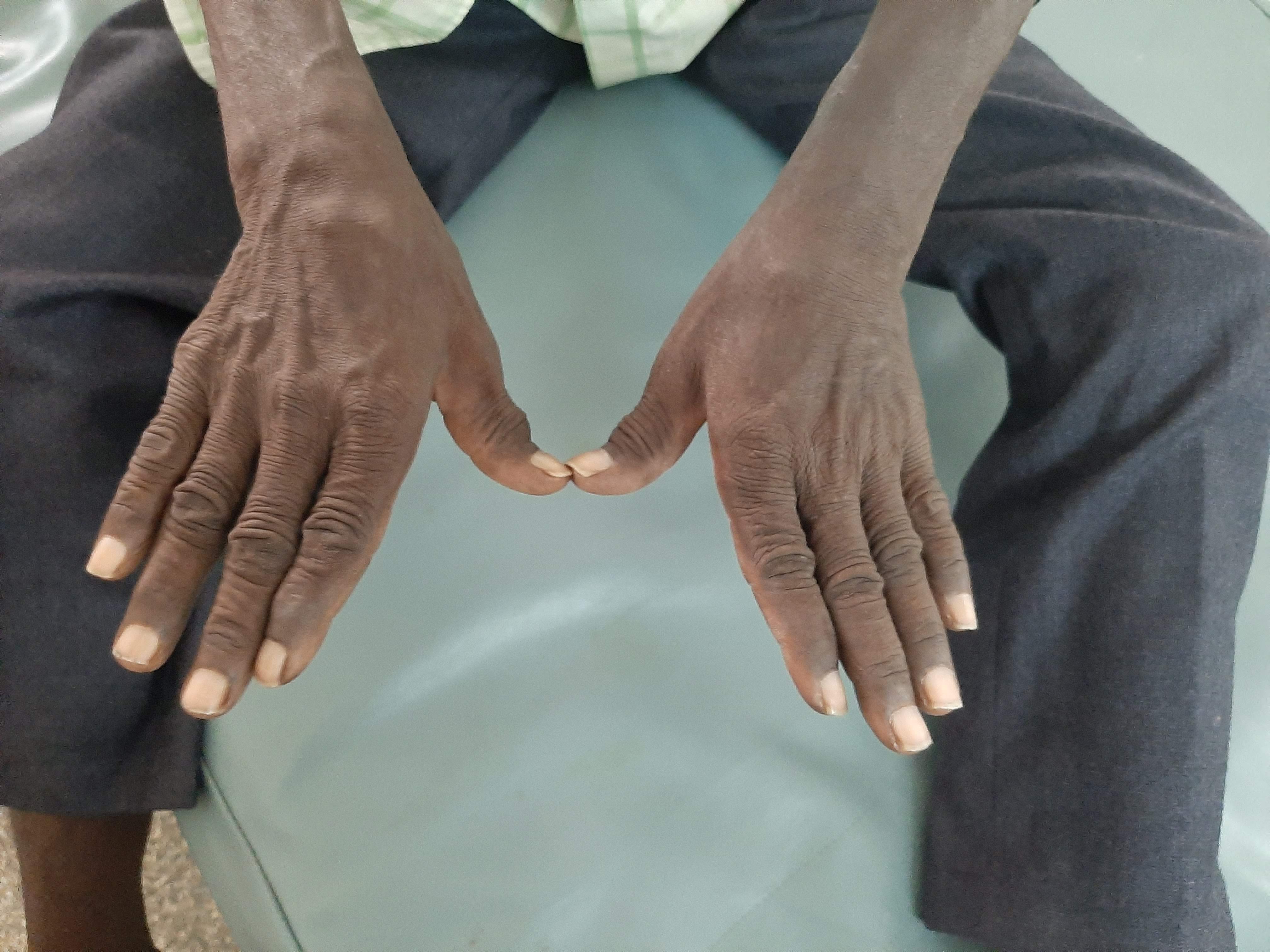 LONG CASE FOR PRACTICAL EXAMINATION