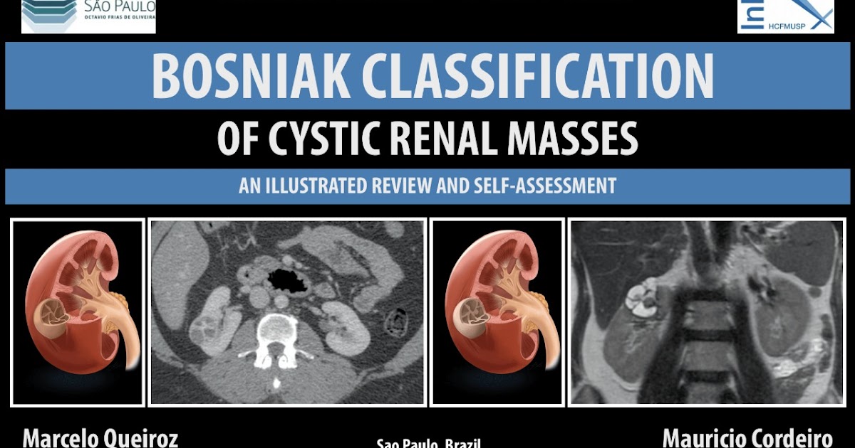 Bosniak Classification