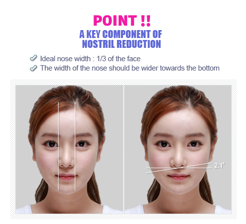 Wonjin Beauty Medical Group: [Nose] Nostril Reduction, do you have a ...