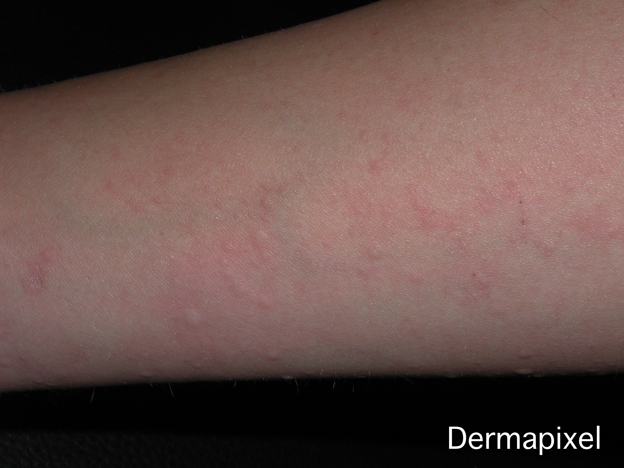 Dermapixel: mayo 2021