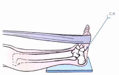 PLANTODORSAL (AXIAL) PROJECTION: LOWER LIMB-CALCANEUS - RadTechOnDuty