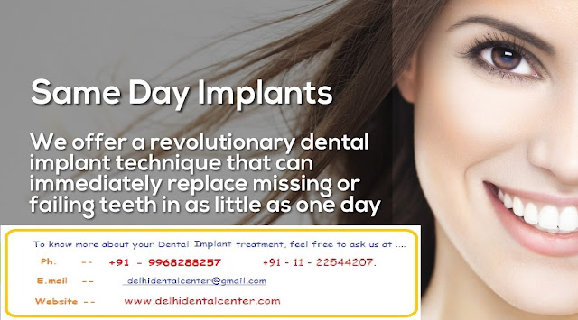 Full Mouth Flapless Keyhole Immediate Dental Implant Treatment ...