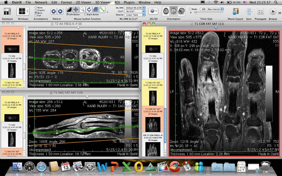 MRI and Medical Imaging: Extremities MRI scanners: exquisite, fast and ...