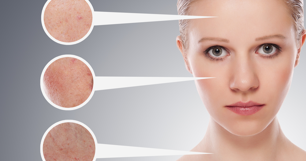 8 ways for Fixing Face Problems