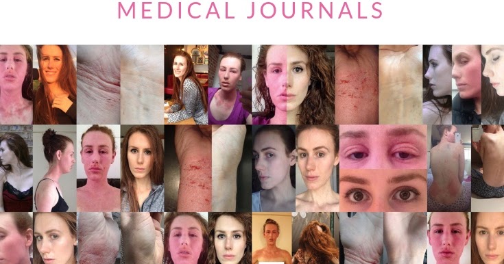 The TSW Database: Medical Journals | TSW Cara