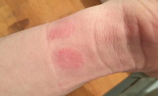 Living With Nickel & Iron Oxide Allergies: iWatch, FitBit and Other ...
