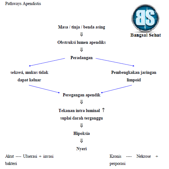 Pathway Apendisitis - Suka Posting