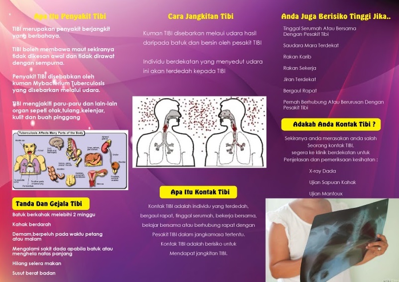 Penyakit Tibi Atau Tuberkulosis Punca Tanda Dan Rawat - vrogue.co