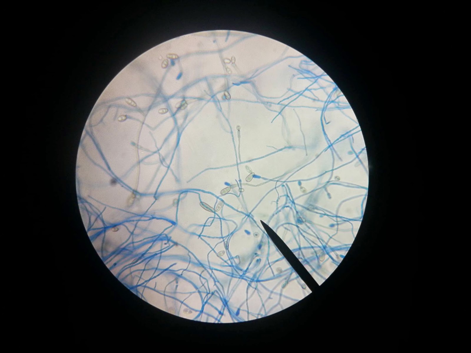 CAMINO DEL ESTUDIANTE DE MEDICINA : PRÁCTICA DE MICOLOGÍA