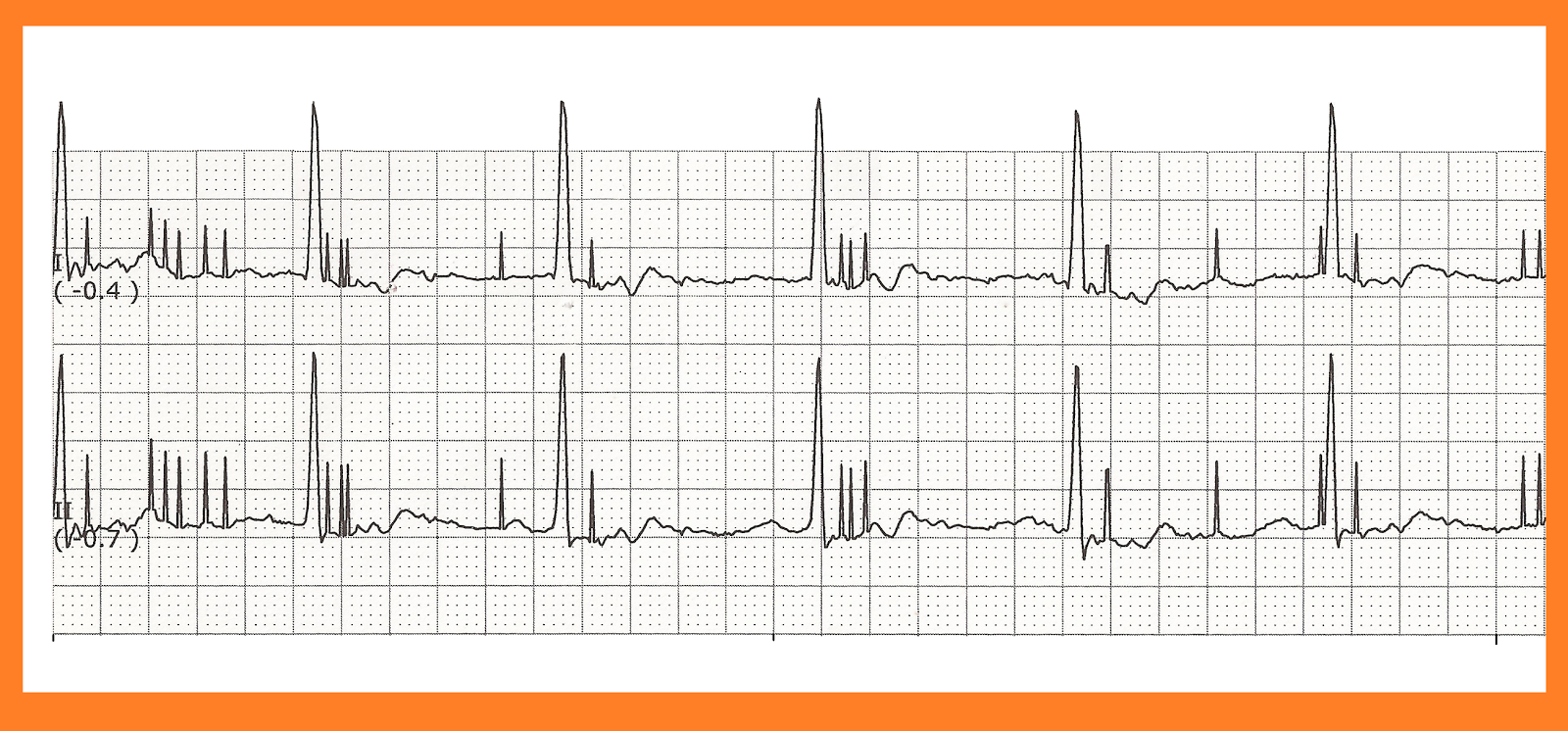 Float Nurse: Practice Rhythm Strips 248