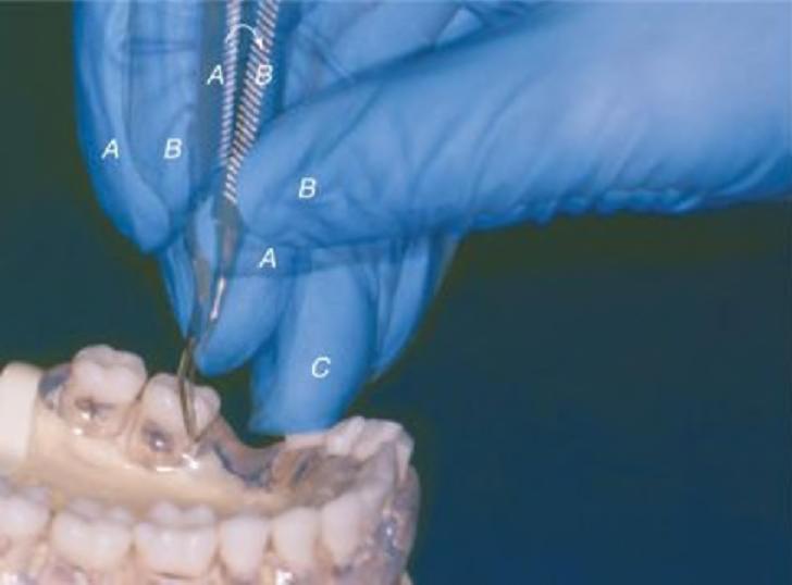 Dentistry lectures for MFDS/MJDF/NBDE/ORE: PRINCIPLES OF ...
