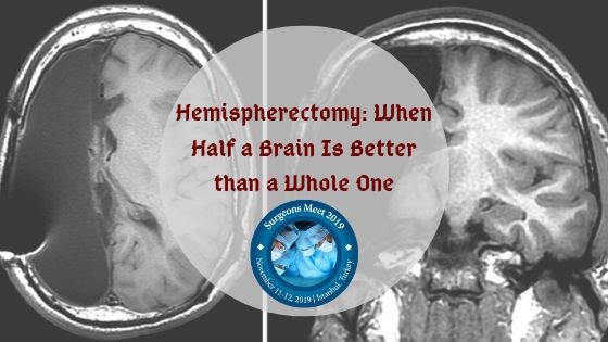 2nd World Congress on Surgeons