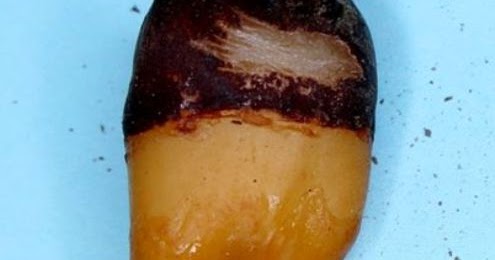 What Effect Have Coca Cola And Energy Drinks On Teeth? - Healthy