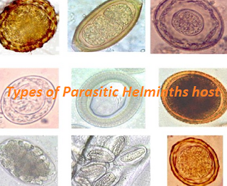 Types of Parasitic Helminths host - CONFIRM INFOZ