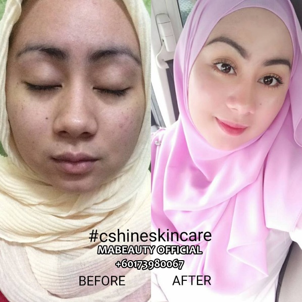 C-SHINE SKINCARE : C-SHINE SERUM , C-SHINE WHITE STRAWBERRY SOAP