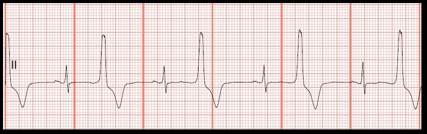 Practice EKG Rhythm Strips 197