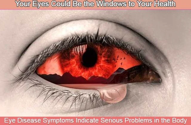 Types of Eye Diseases and Disorders: Symptoms and Causes - How to ...