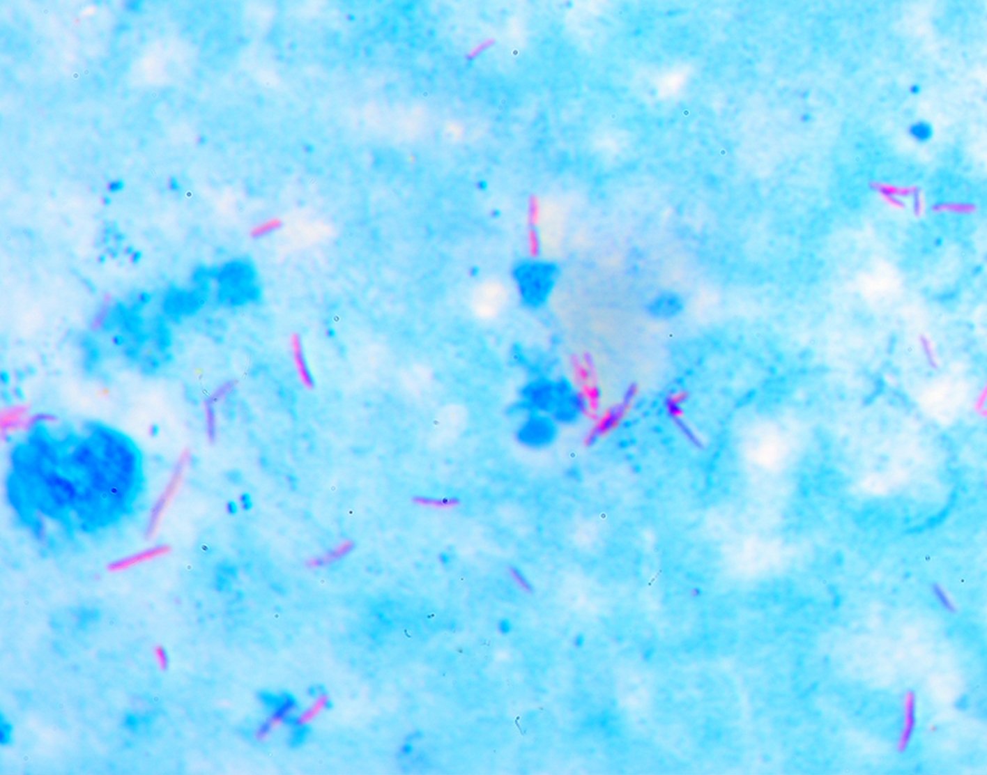 Bakteri Tahan Asam - Homecare24