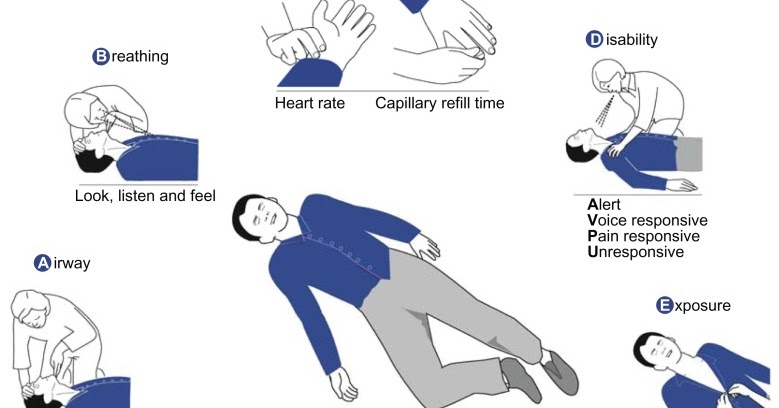 BTCLS: BASIC TRAUMA, CARDIAC AND LIFE SUPPORT: FIRST INITIAL ASSESSMENT