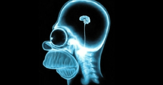 Youthful Brain Now!: Is Your Brain Shrinking?: What You Need to Know