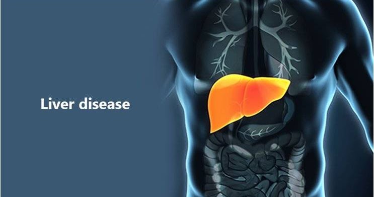 Liver Disease, Symptoms and causes