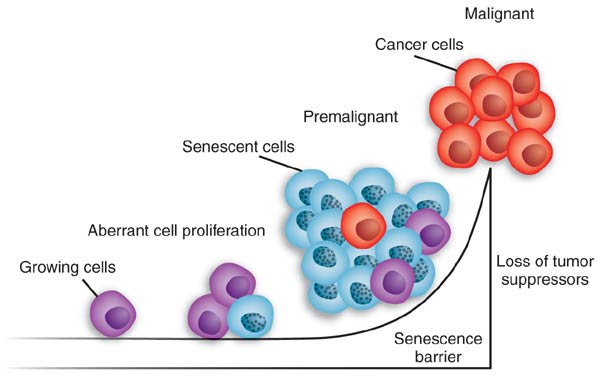 CÉLULAS SENESCENTES PODRÍAN RETRASAR EL CÁNCER